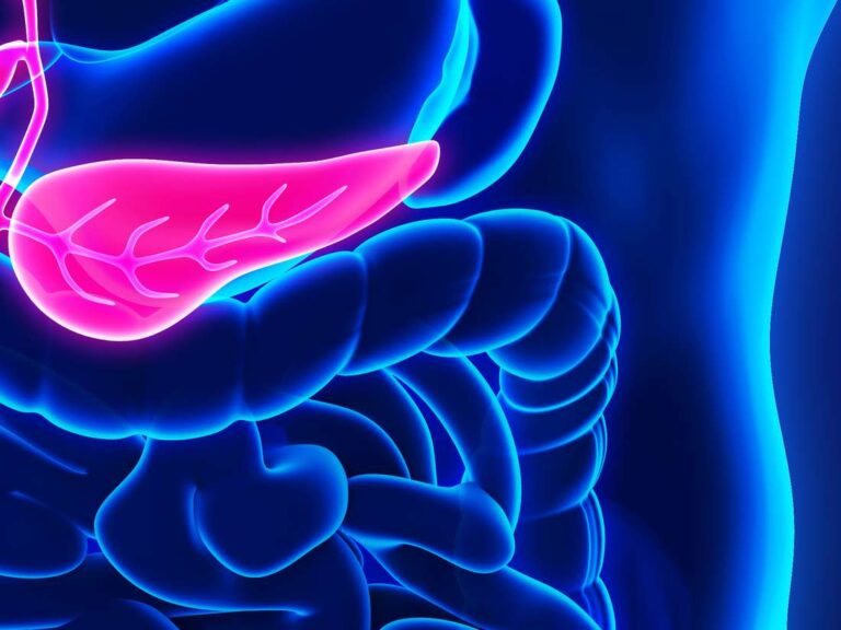 Cancro del pancreas: farmaco mirato lo contrasta - MediMagazine