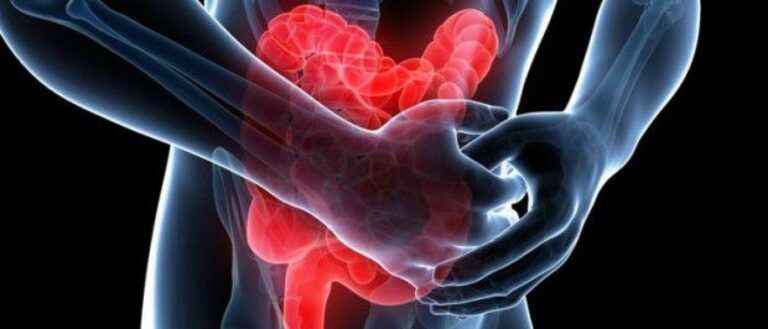 L'interleuchina-11 migliora gli esiti della colite acuta - MediMagazine