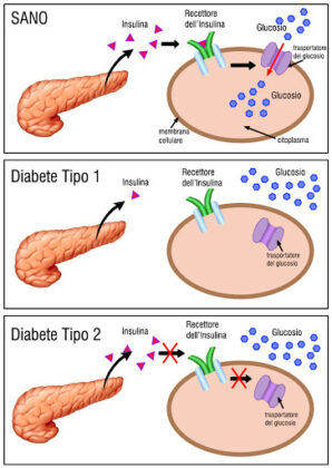 Diabete di tipo I: farmaco sperimentale designato"terapia rivoluzionaria" - MediMagazine