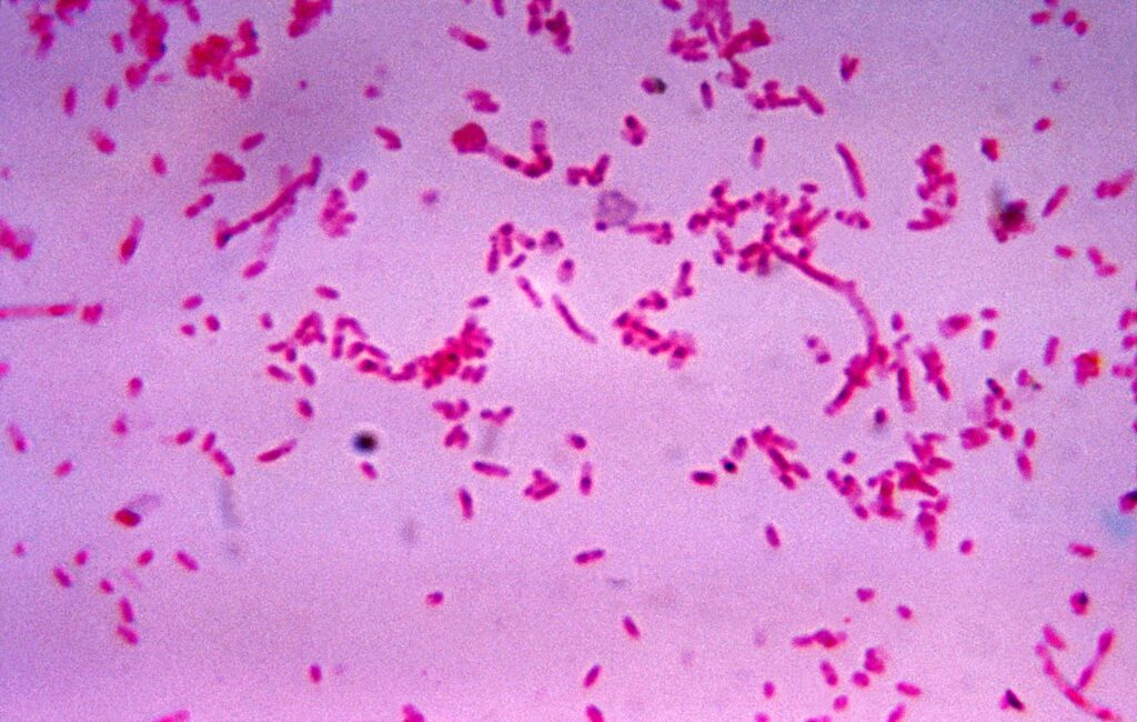 Il Fusobacterium nucleatum induce la proliferazione e la migrazione ...