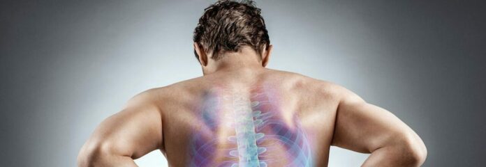 "Sindrome dell'uomo rigido", esperto spiega la condizione - MediMagazine